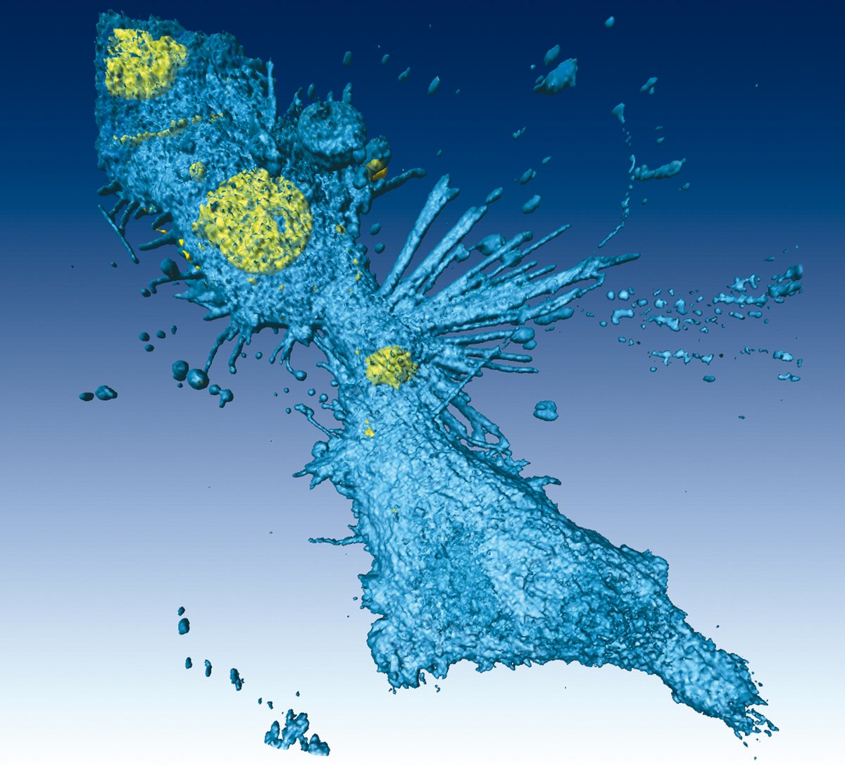 Methylation analysis improves lung cancer risk prediction - German ...