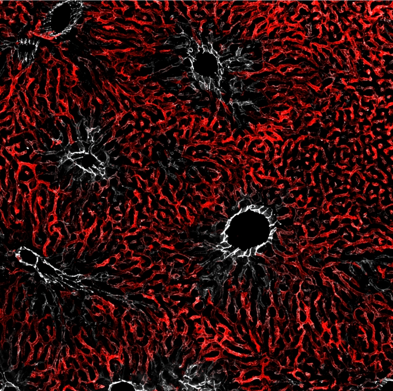 High-resolution molecular map of endothelial cells identifies new ...
