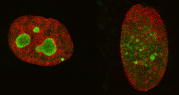 RNA Klebstoff für die Protein-Montage - Deutsches Krebsforschungszentrum