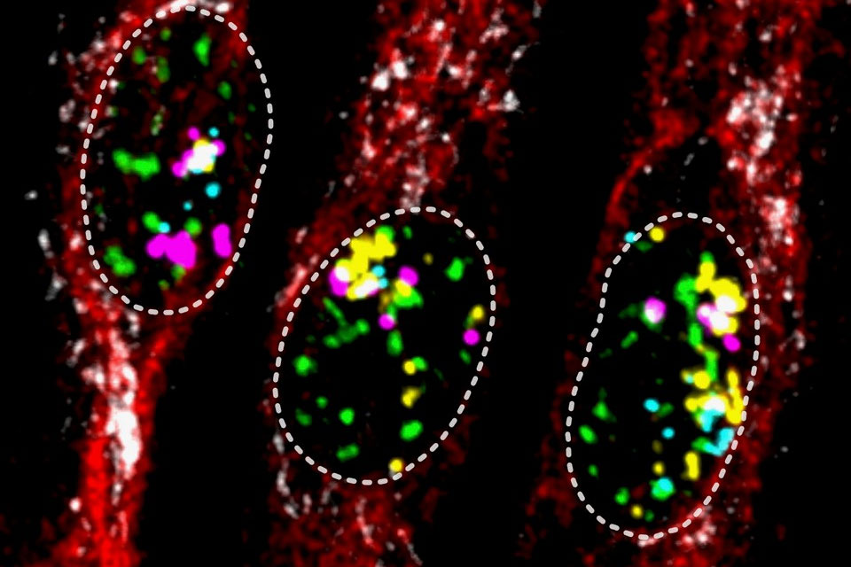 How cells control inflammatory responses - German Cancer Research Center